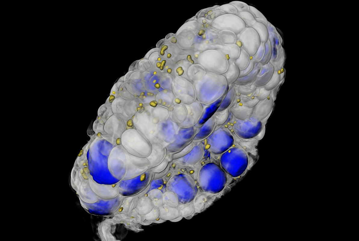 Metaprogramme DIGIT-BIO - Comprendre